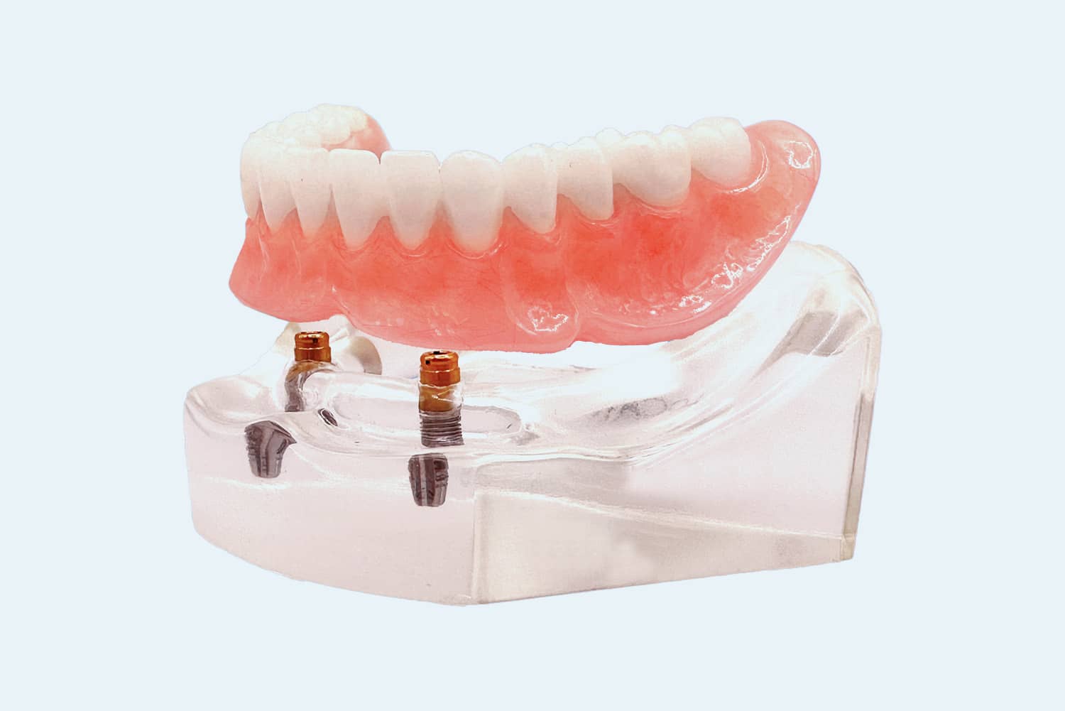 Implant Dentures Long Island | Island Dental Associates